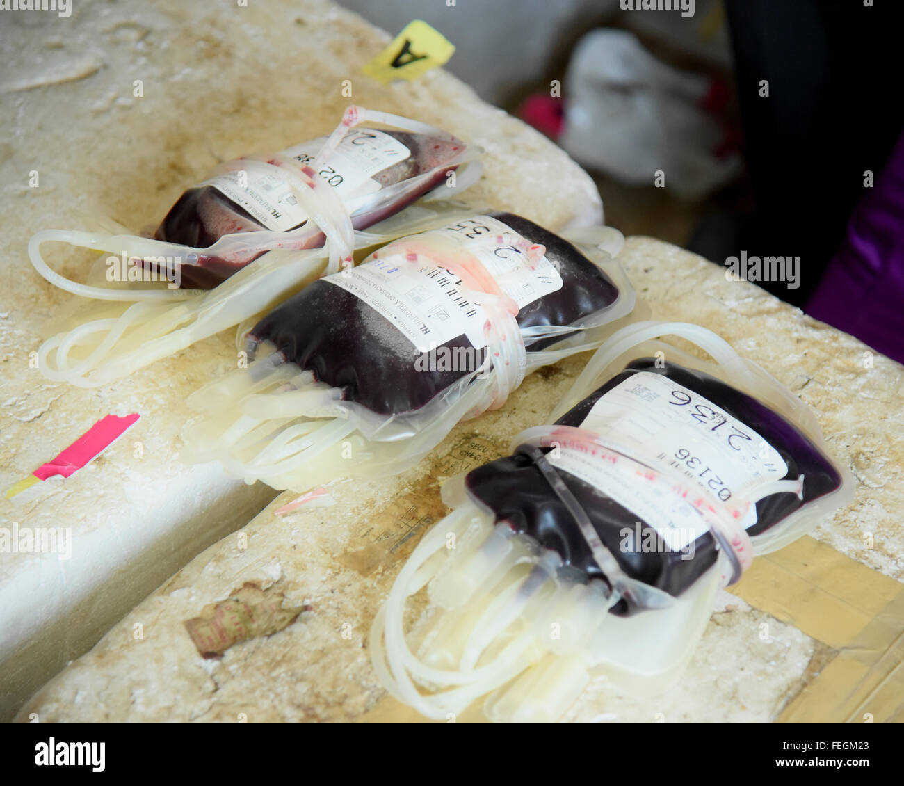 Binaker, India. 07th Feb, 2016. Collected blood during a blood letting ...