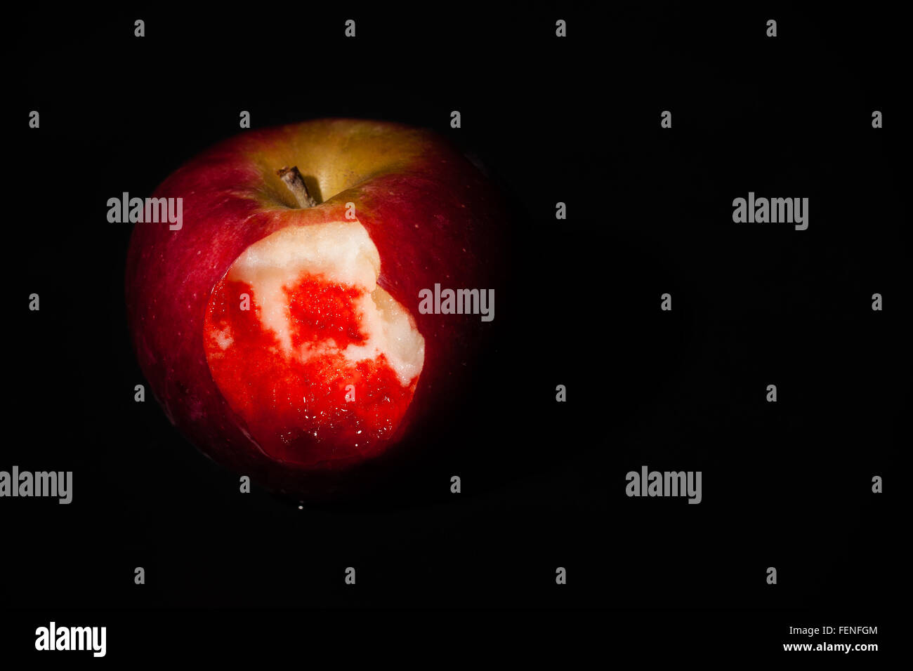 Blood poisoning hi-res stock photography and images - Alamy