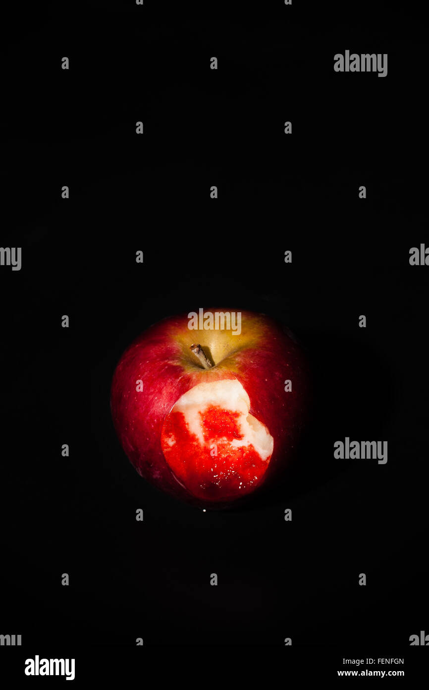 Blood poisoning hi-res stock photography and images - Alamy