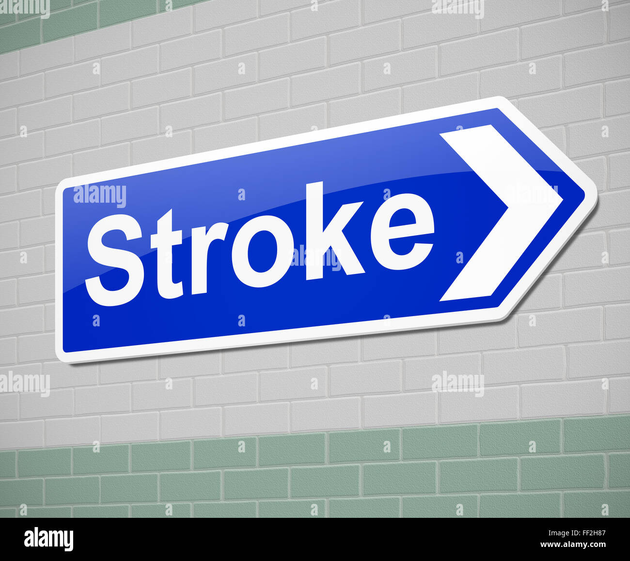 Ischemic stroke hi-res stock photography and images - Alamy