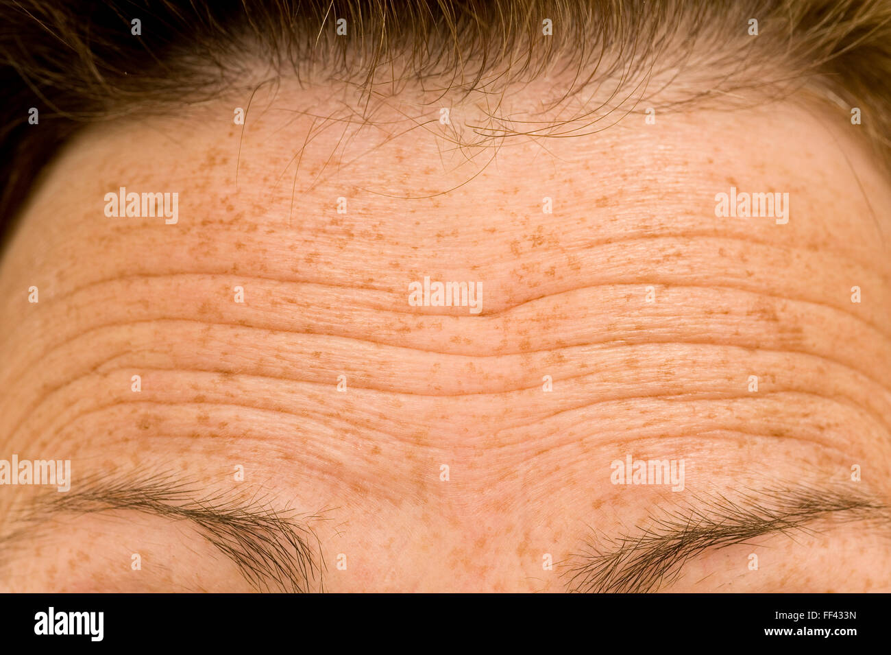 Wrinkled forehead hi-res stock photography and images - Alamy