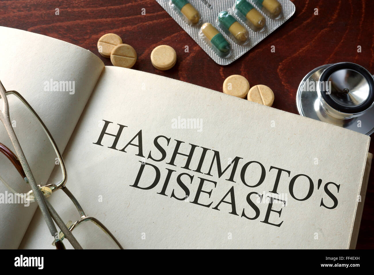 Hashimoto disease hi-res stock photography and images - Alamy