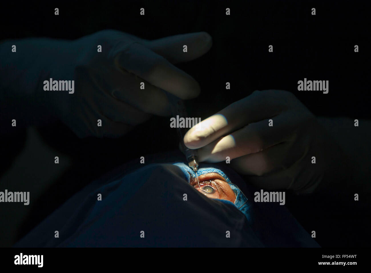 Dr Mohamed Shaheen performs Cataracts surgery on a patient on the IFB ...