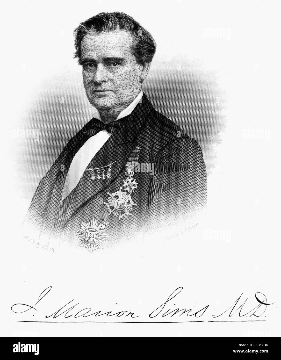 JAMES MARION SIMS /n(1813-1883). American physician. Steel engraving ...