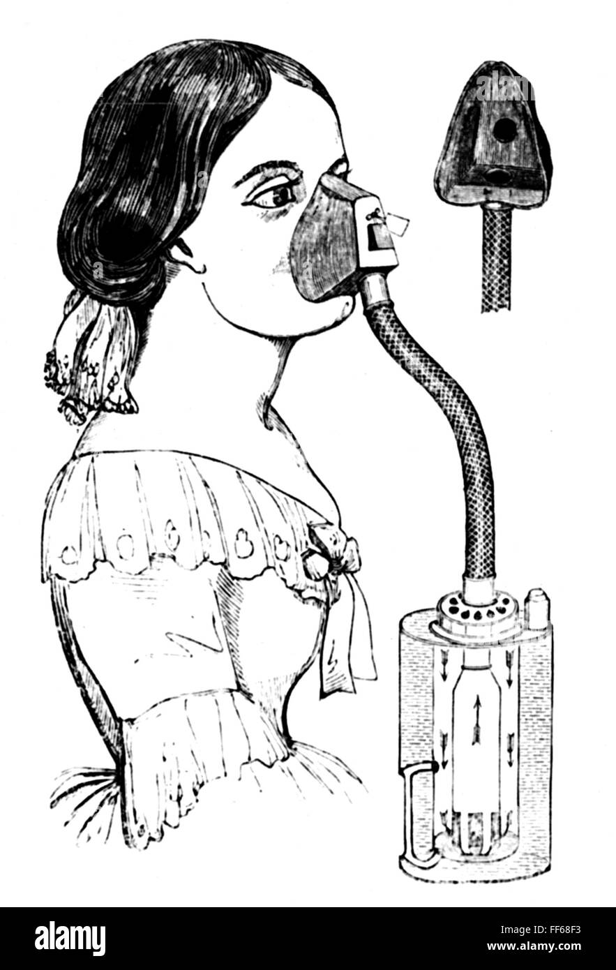 CHLOROFORM INHALER, 1858. /nA chloroform inhaler. Illustration from 'On ...