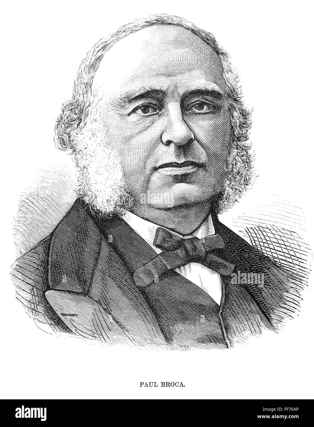 PAUL BROCA (1824-1880). /nFrench surgeon and anthropologist. Wood ...