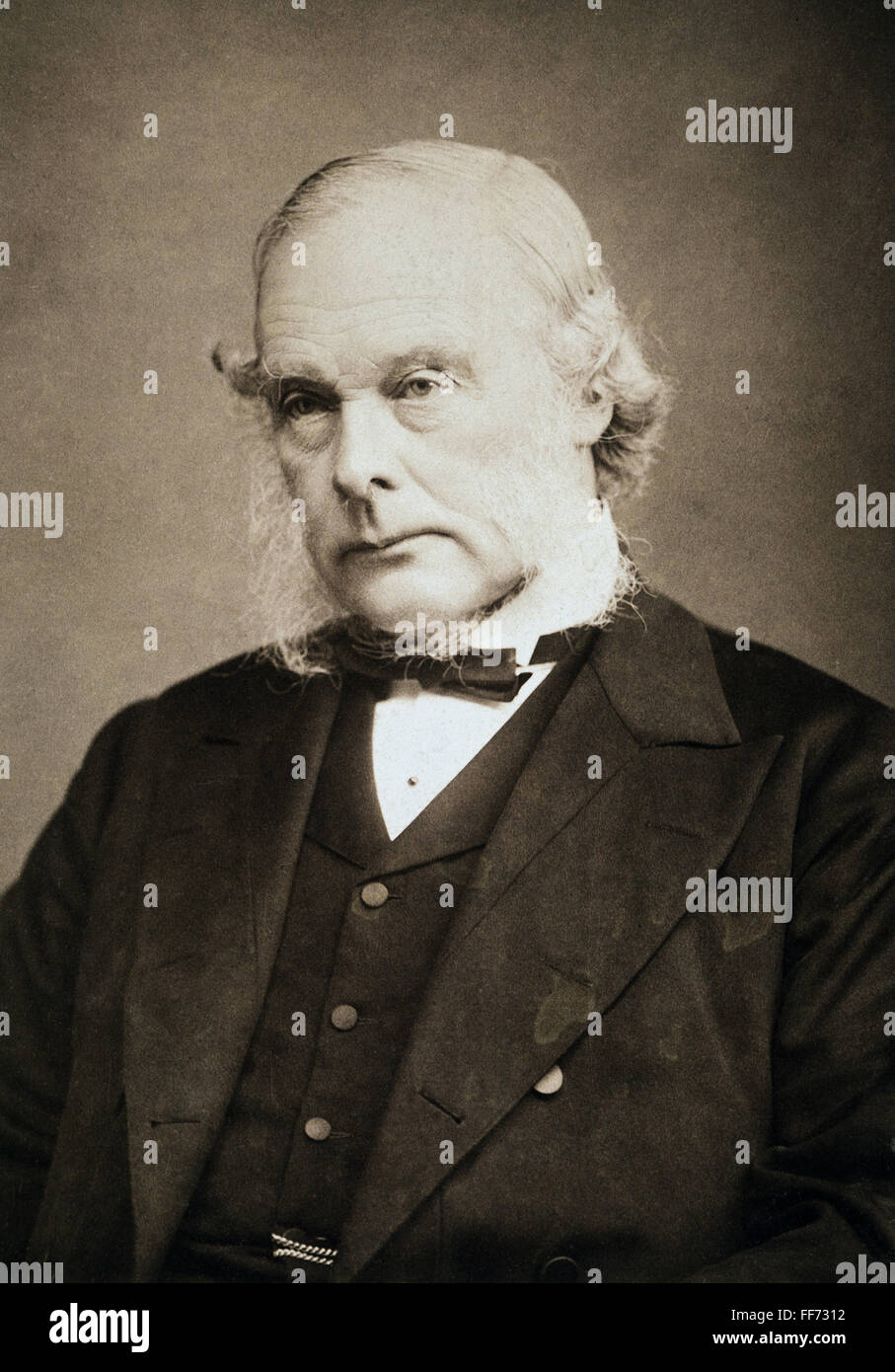 JOSEPH LISTER (1827-1912). /n1st Baron Lister of Lyme Regis. English ...