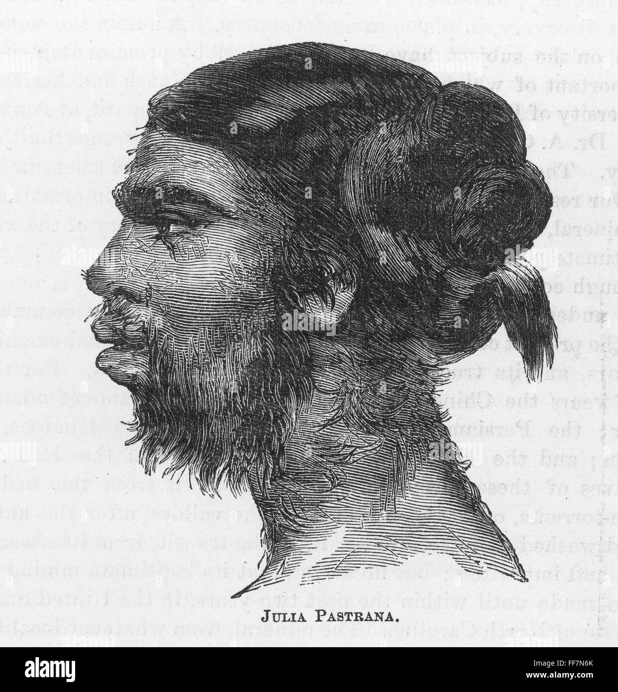 BEARDED LADY. /nJulia Pastrana, a celebrated bearded lady of the 19th ...