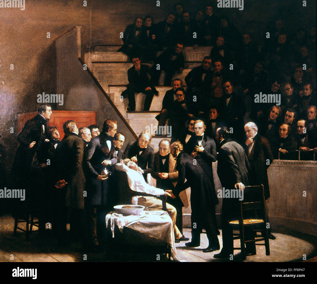 SURGERY WITH ANESTHESIA. /nFirst public demonstration of surgery with ...