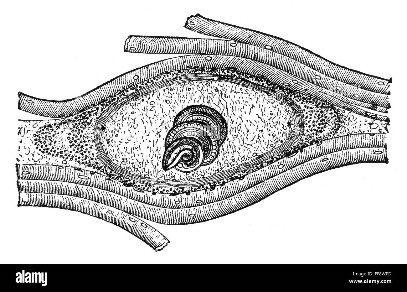 TRICHINA, 19th CENTURY. /nA trichina worm (Trichinella spiralis) coiled ...
