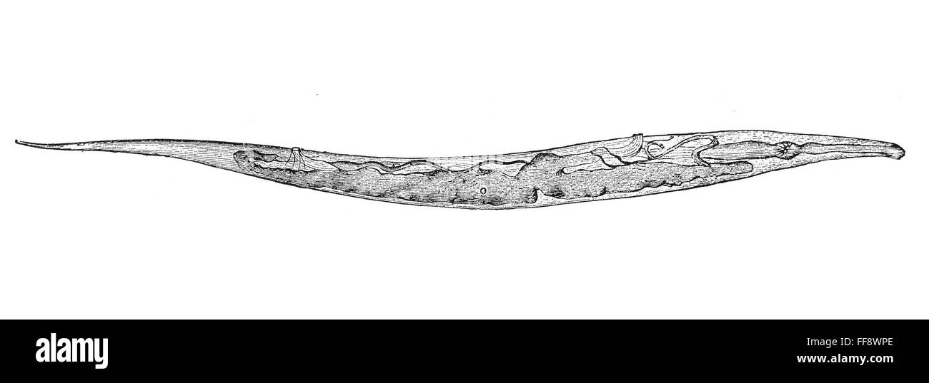 THREADWORM, 19th CENTURY. /nA threadworm (Strongyloides stercoralis ...