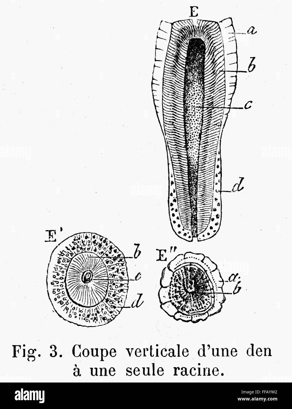 TOOTH WITH ONE ROOT. /nVertical section. Line engraving, French, 19th ...