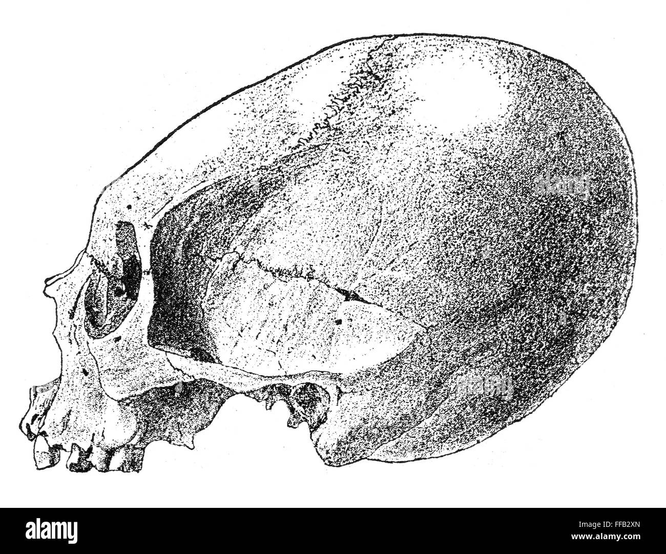PERU: AYMARA SKULL. /nArtificially deformed skull of an Aymara Native ...