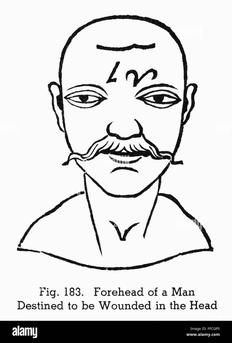 PHYSIOGNOMY, 1658. /nForehead of a man destined to be wounded in the ...