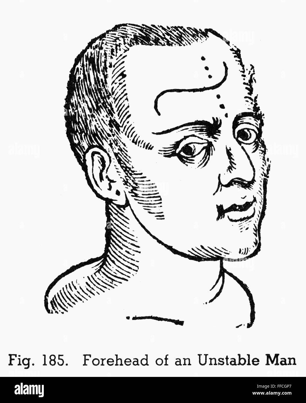 PHYSIOGNOMY, 1648. /nForehead of an unstable man. Woodcut, 1648, from ...