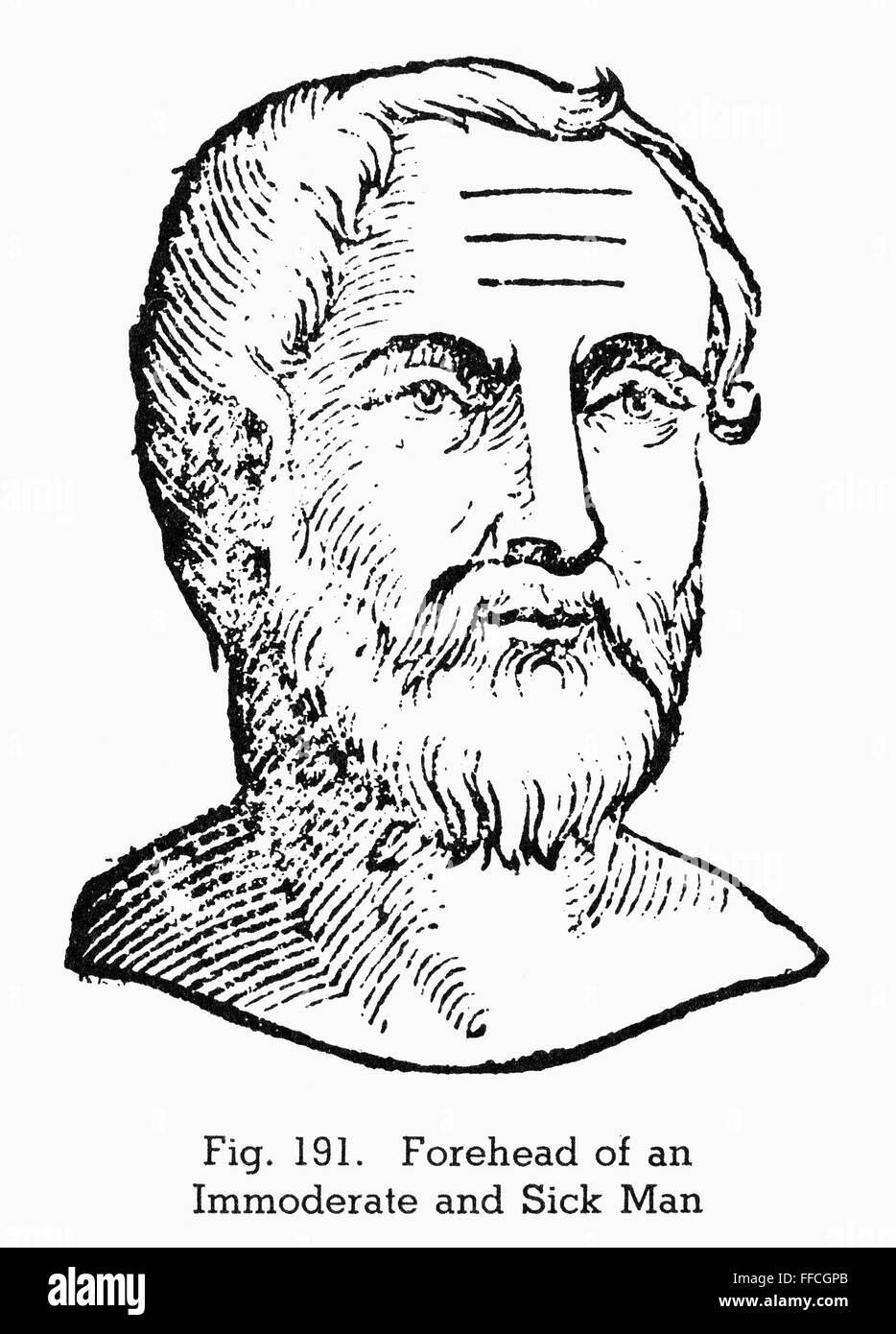 PHYSIOGNOMY, 1637. /nForehead of an immoderate and sick man. Woodcut ...