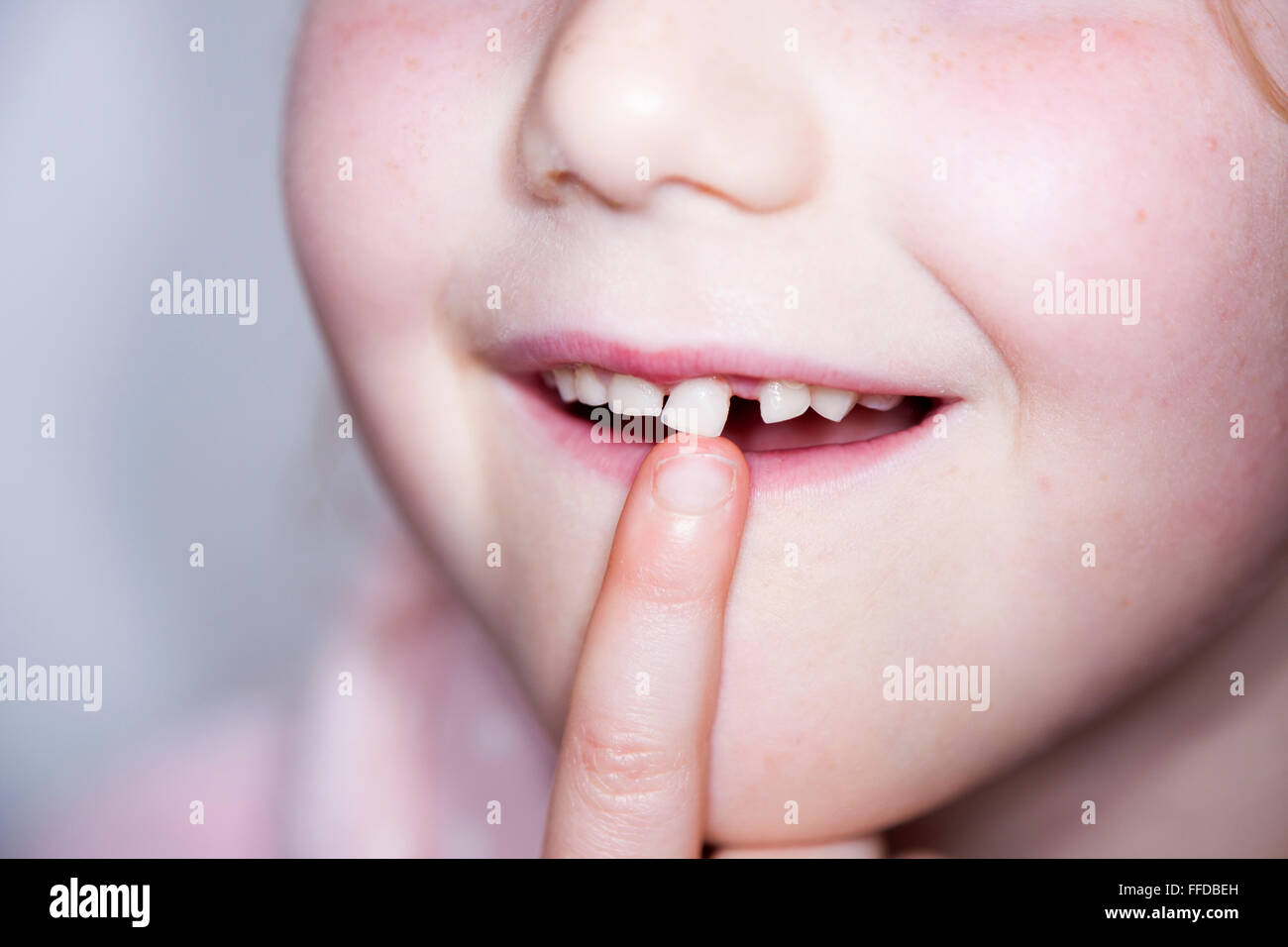 Milk teeth hi-res stock photography and images - Alamy