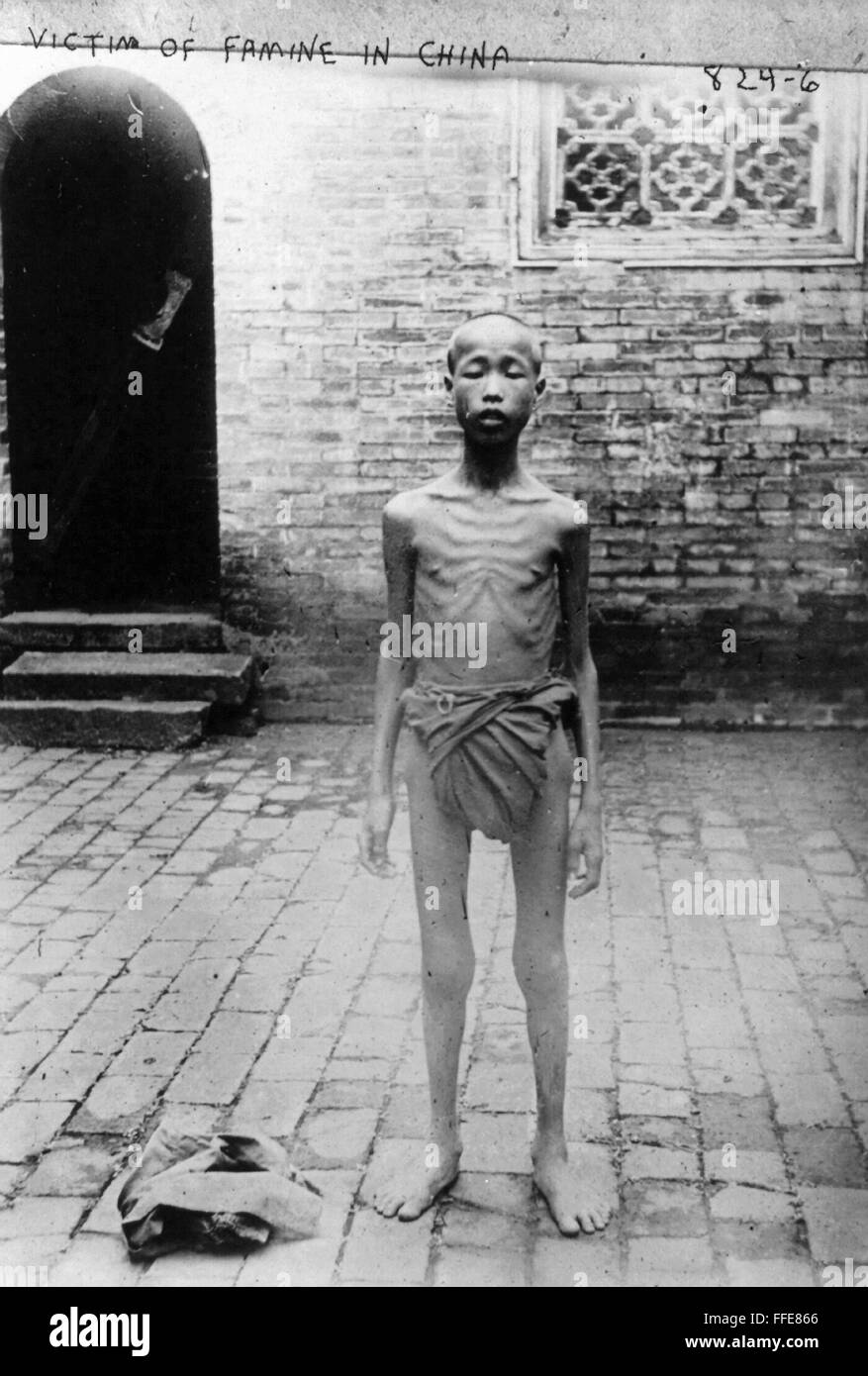CHINA: FAMINE VICTIM. /nStarving Chinese boy begging on the street ...