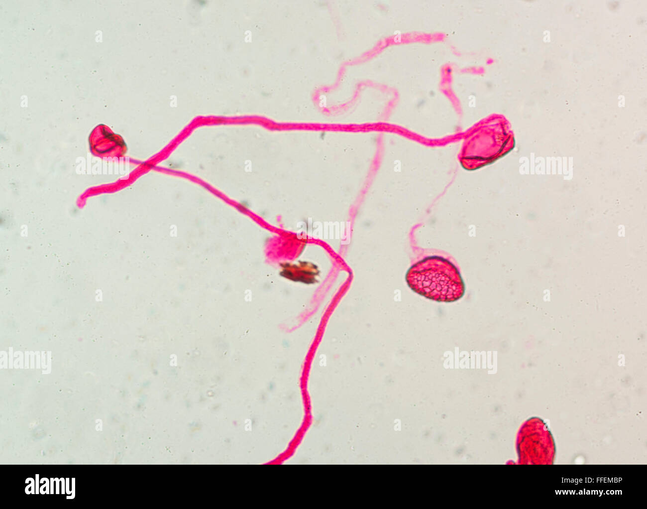 Microscopic objects hi-res stock photography and images - Alamy