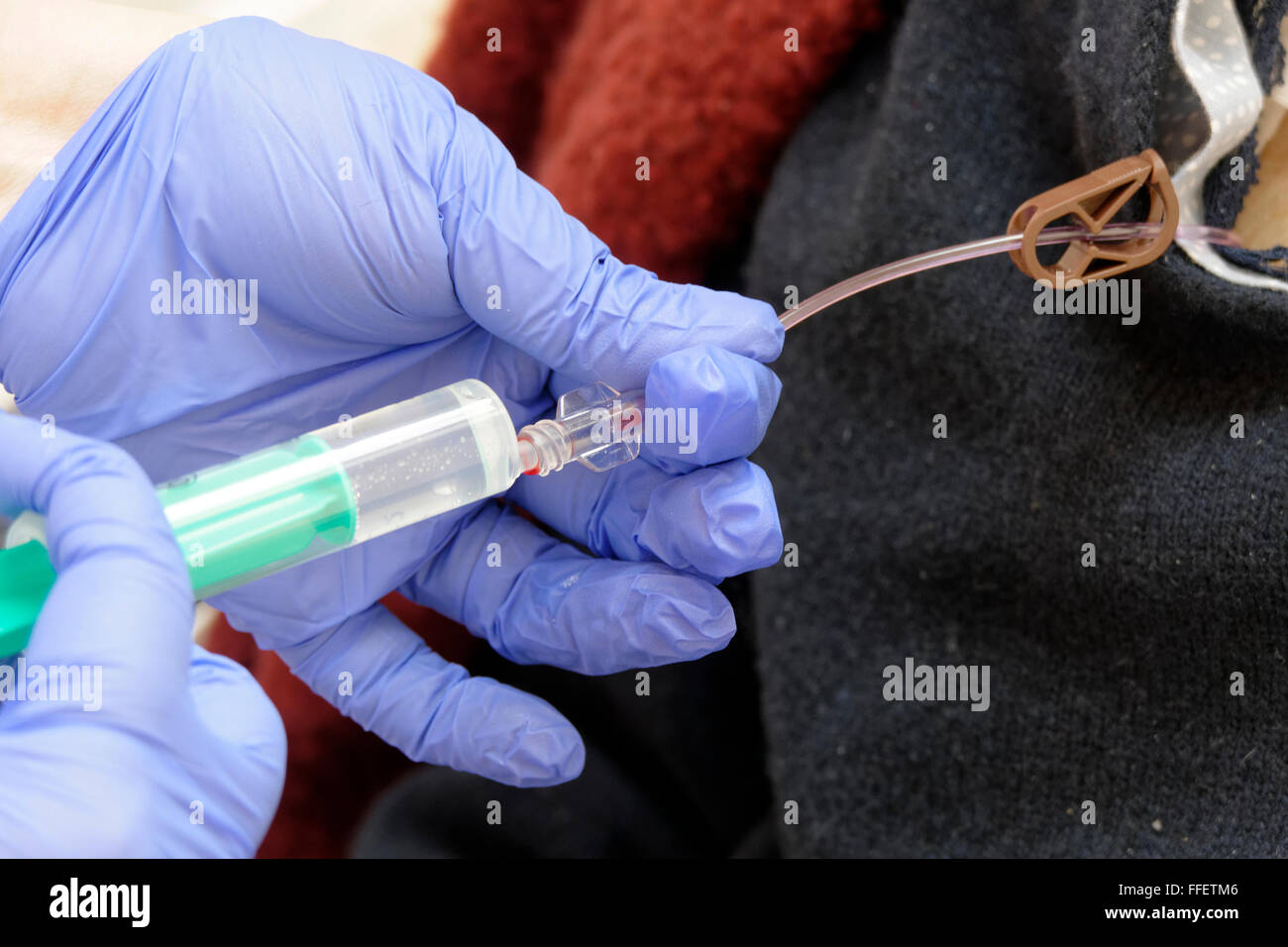 Medical port tube and connection being cleaned with a syringe Stock ...