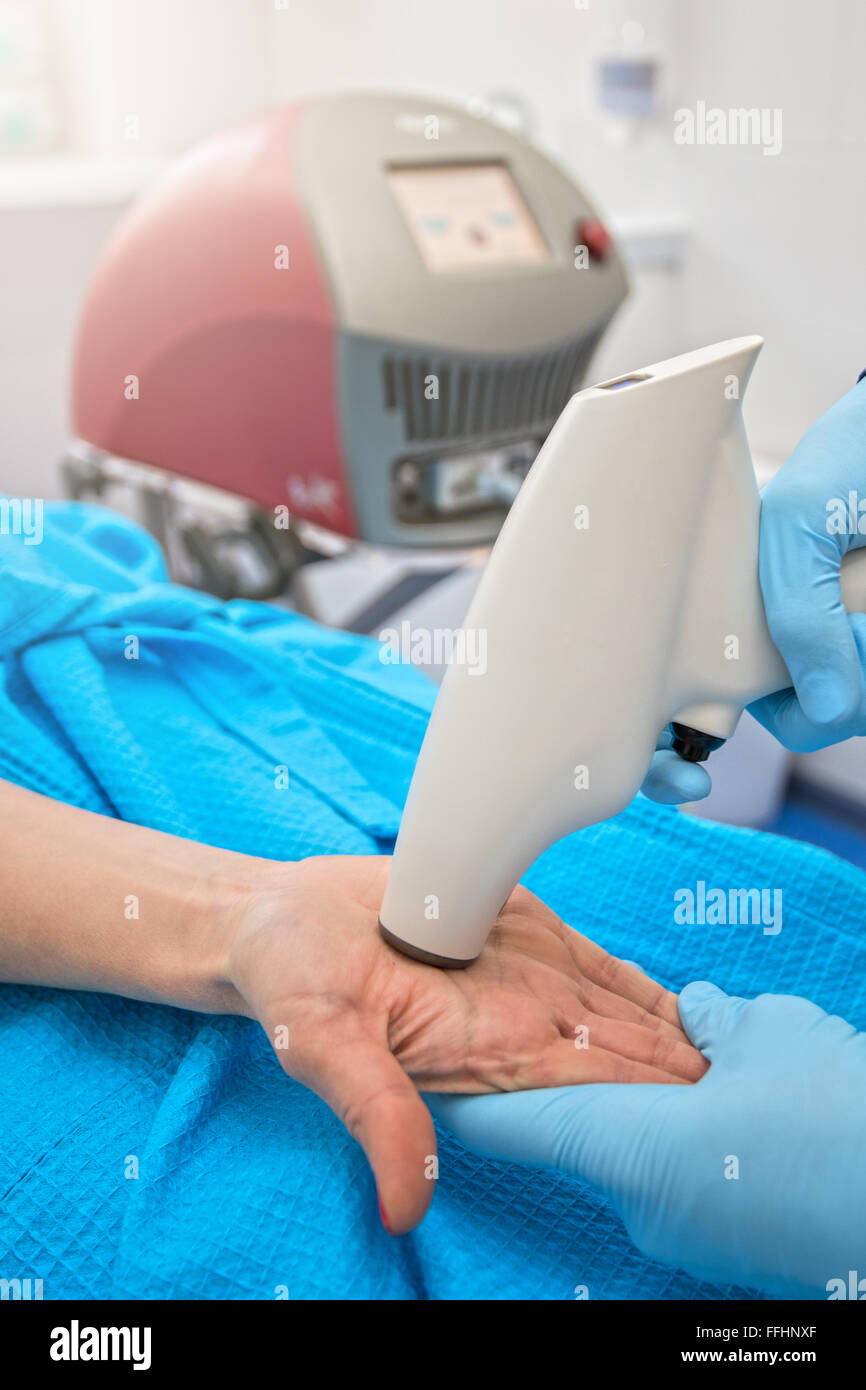Procedure for palm against hyperhidrosis Stock Photo - Alamy