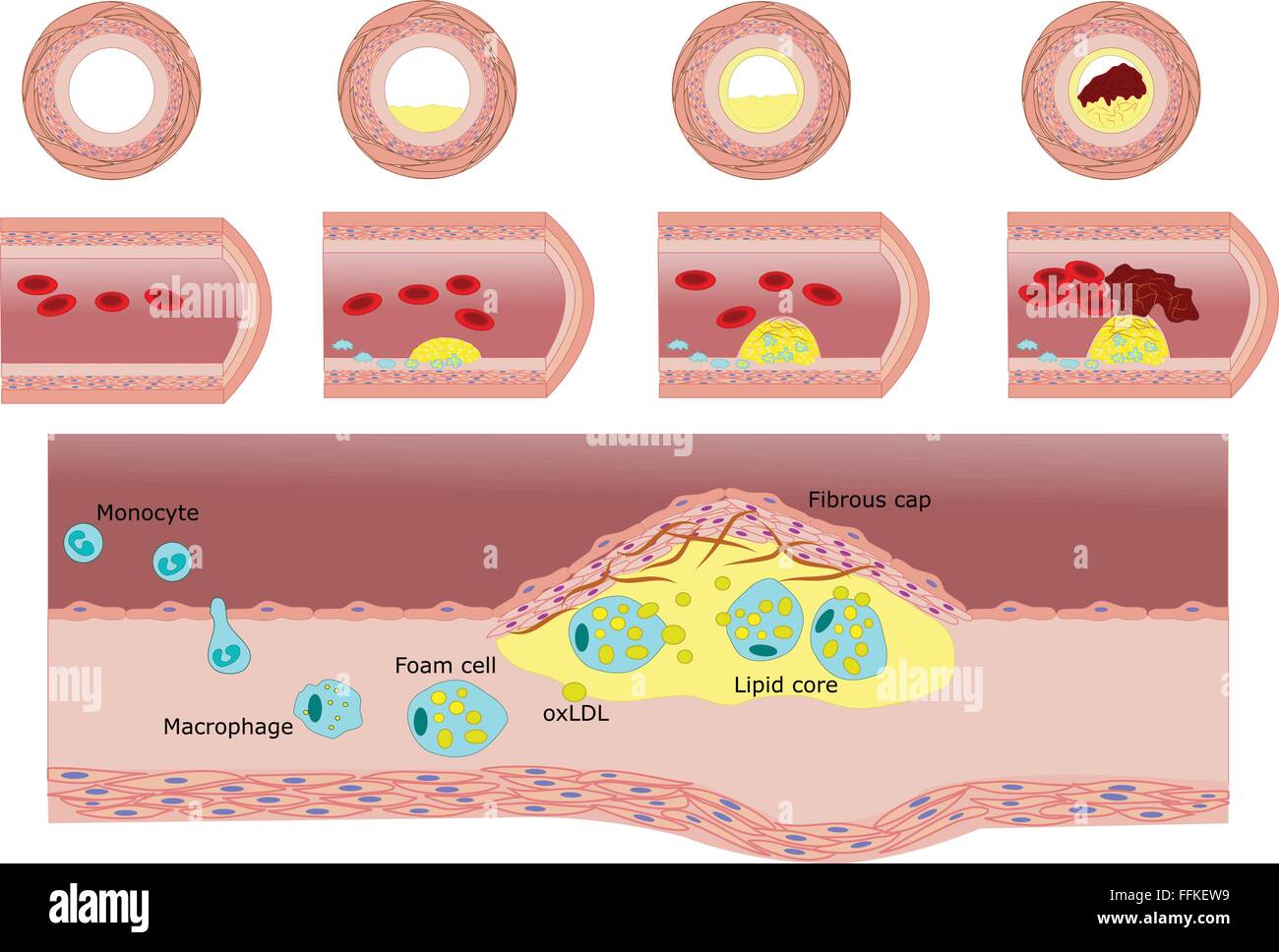 Blood monocyte Stock Vector Images - Alamy