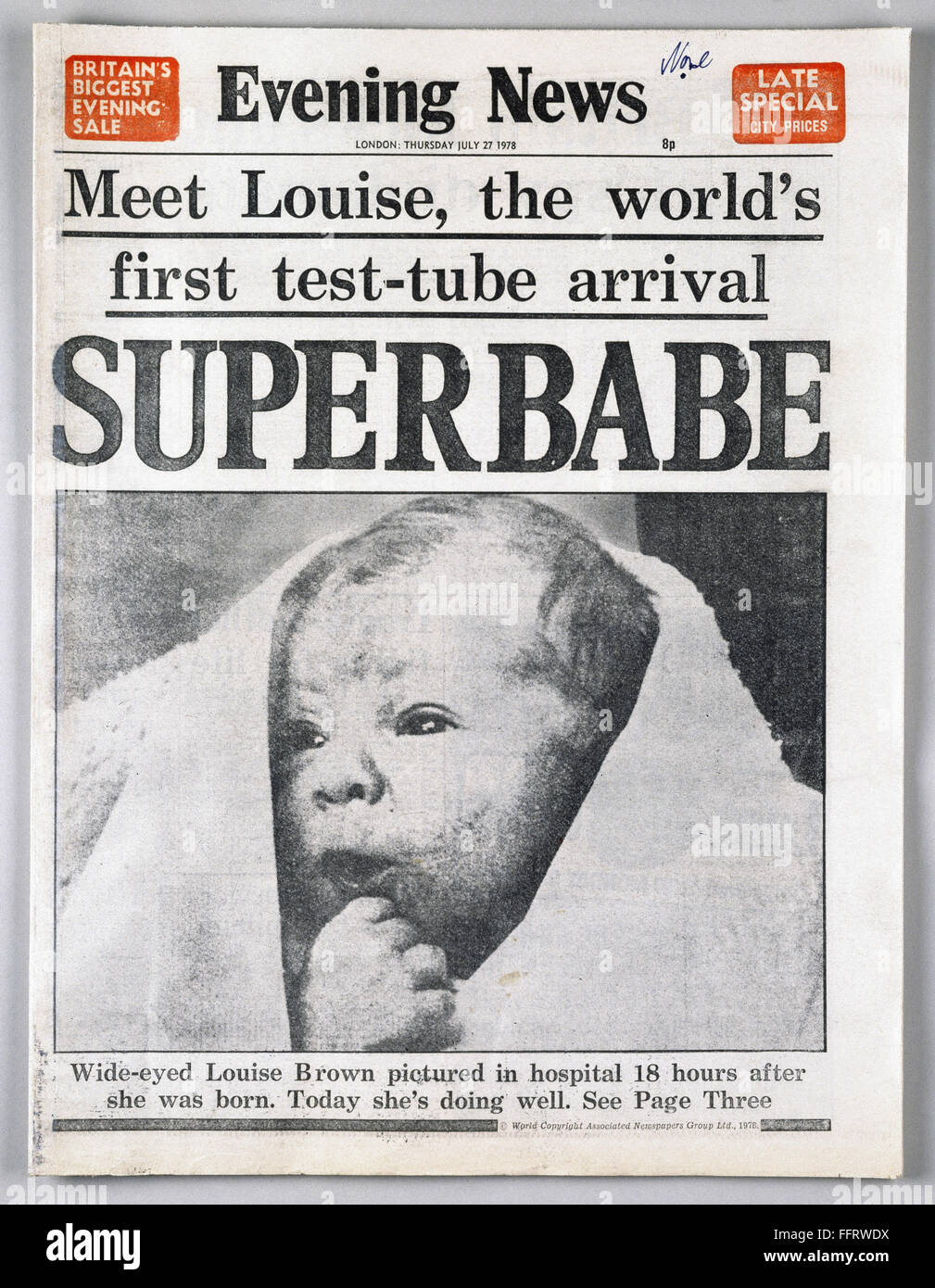 First Test Tube Baby Louise Brown 1978