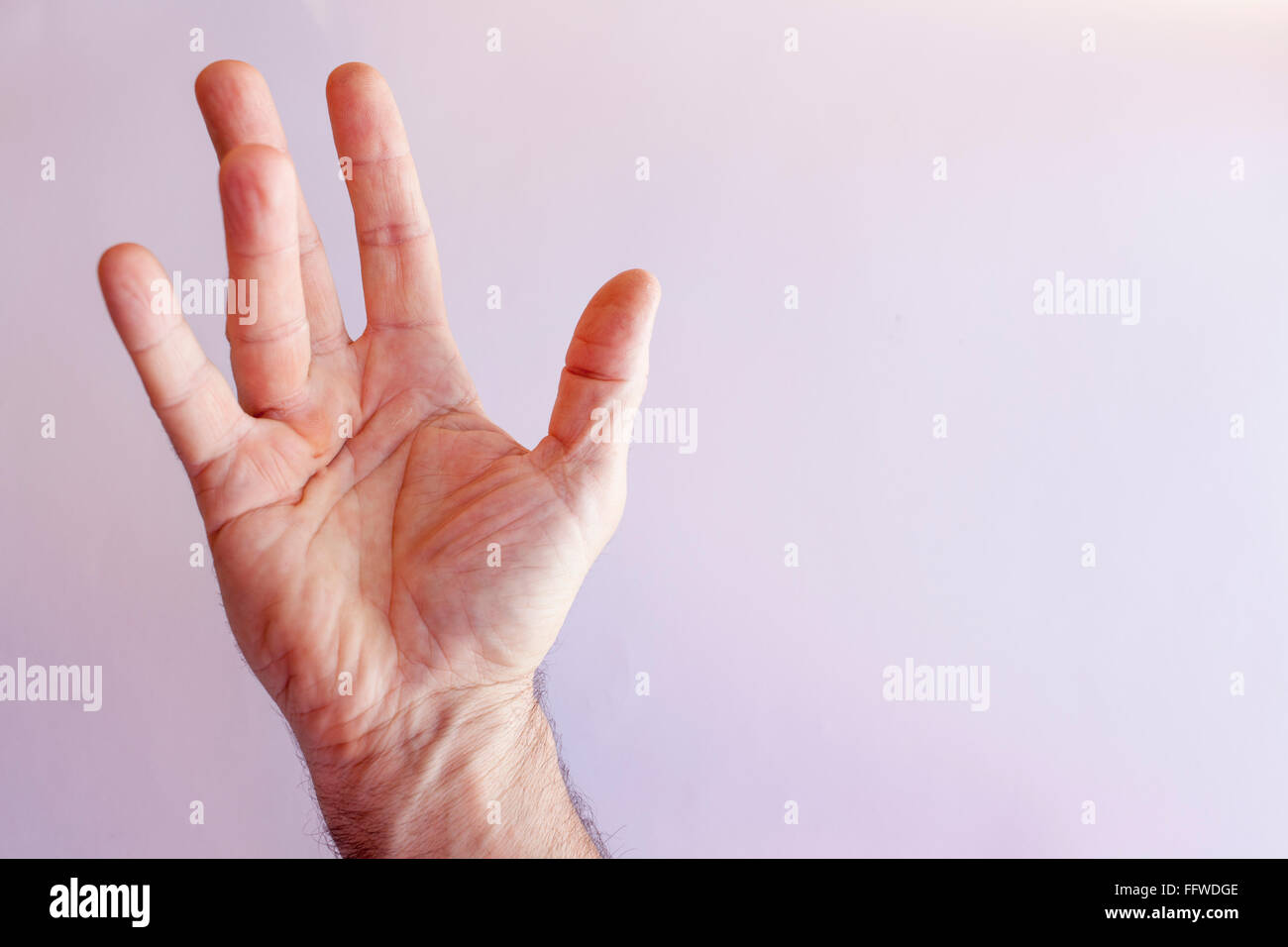 Hand of an man with Dupuytren contracture Stock Photo - Alamy