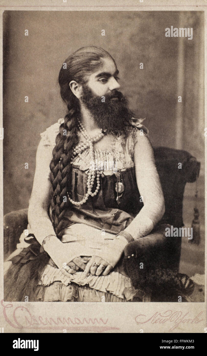 Bearded Lady Annie Jones