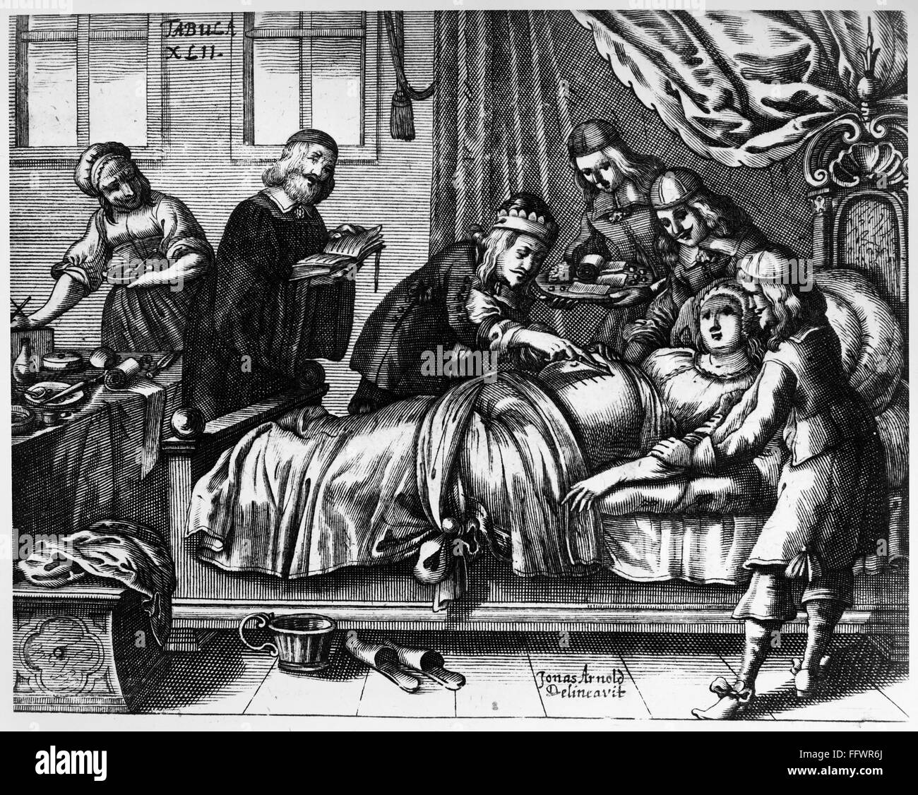 CAESAREAN SECTION, 1666. /nA doctor preparing a woman for childbirth by ...