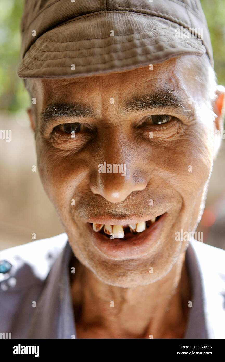old man wearing cap with tobacco stained uneven teeth MR#711 Stock ...