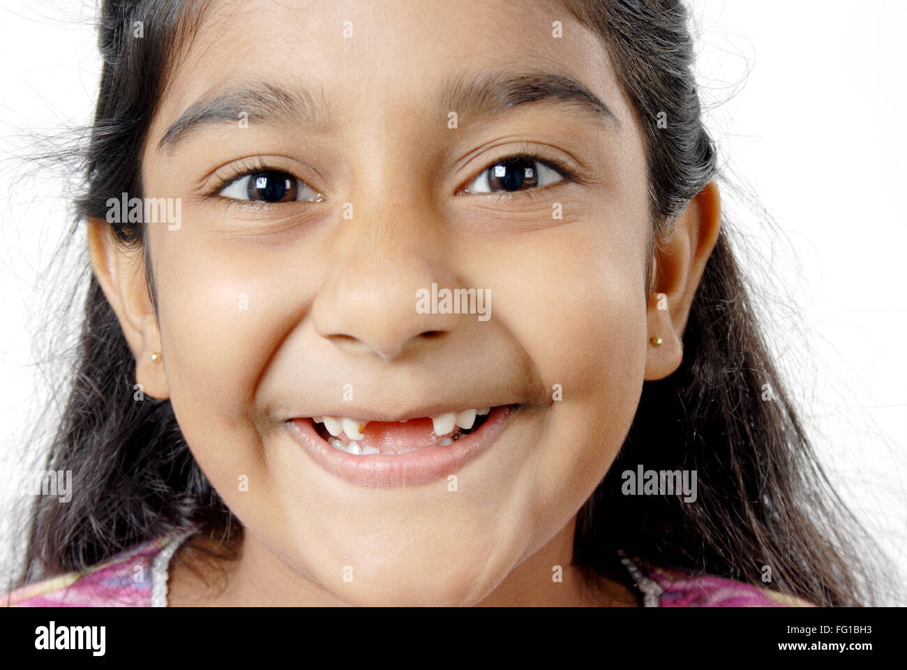 Young girl showing her broken teeth looking at camera MR# 152 Stock ...