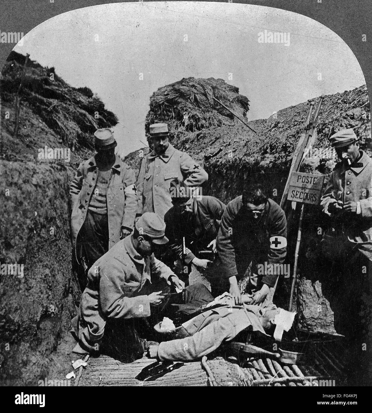 WORLD WAR I: WOUNDED. /nA wounded French soldier being cared for in a ...