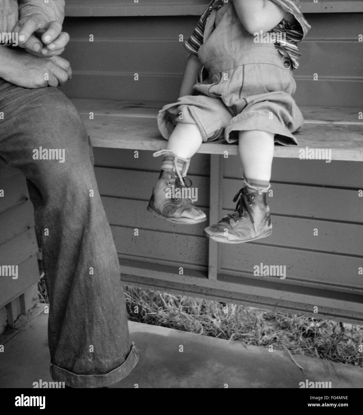 CLUB FOOT, 1939. /nA boy with club feet wearing homemade splints at a ...