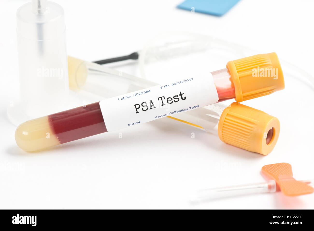 PSA analysis collection tube with blood collection supplies. Serial ...