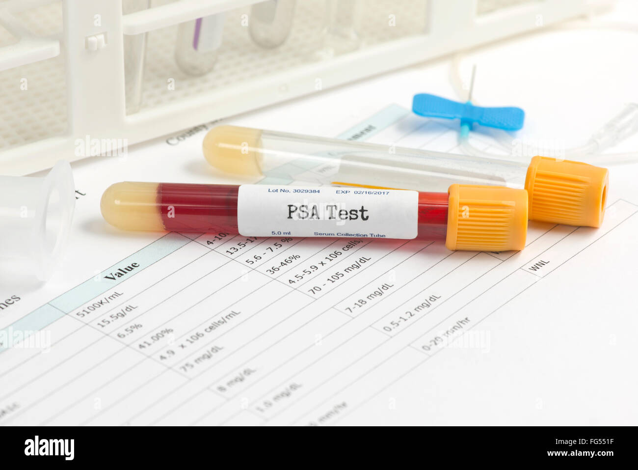 Prostate specific antigen hi-res stock photography and images - Alamy