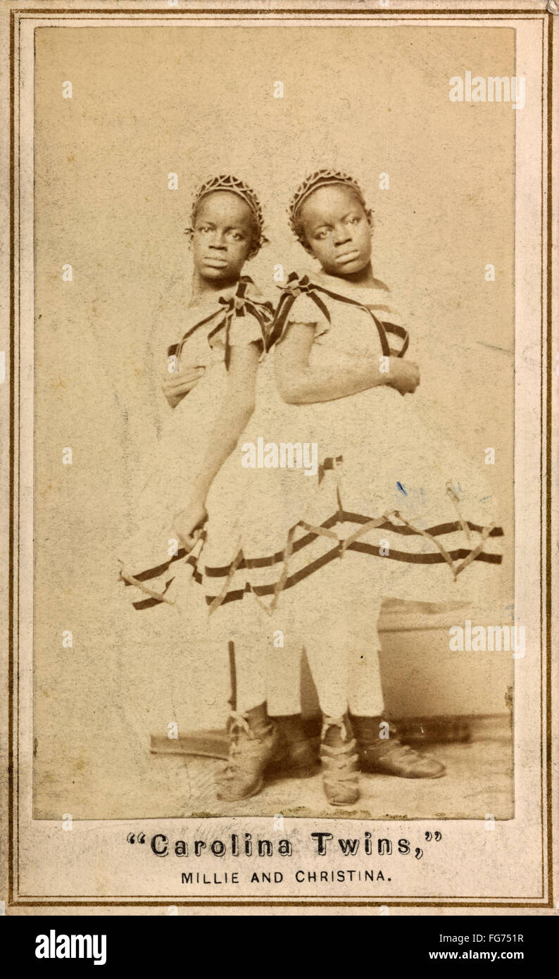 THE CAROLINA TWINS, c1866. /nMillie and Christine McKoy, American ...
