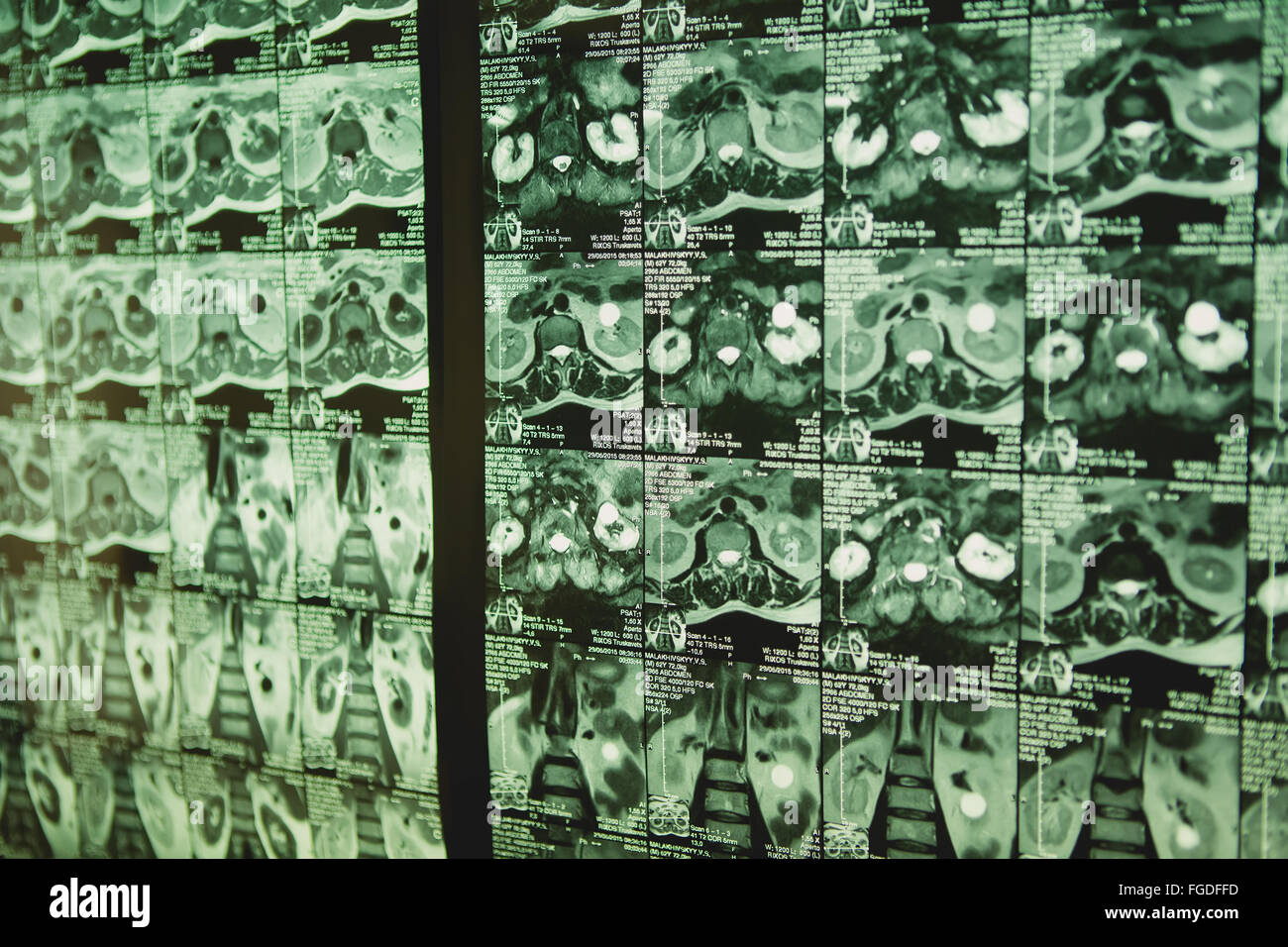 computed tomography of the chest. Medical background Stock Photo - Alamy