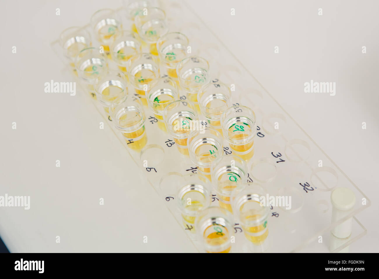 Lab tech loading samples into a chemistry analyzer Stock Photo - Alamy