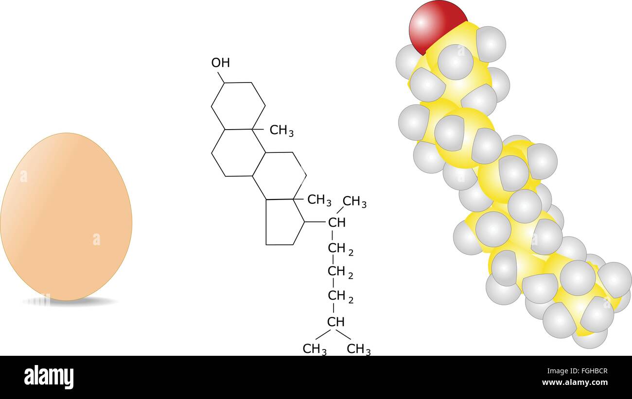 The hypercholesterolemia Stock Vector Images - Alamy