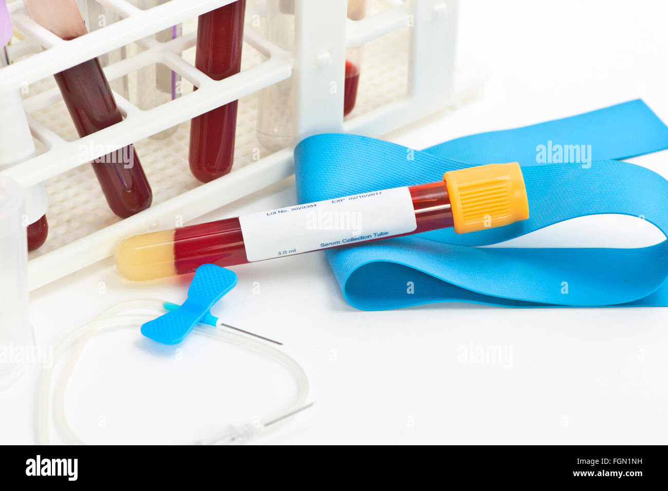HIV blood analysis collection tube with tube rack. Labels and document ...