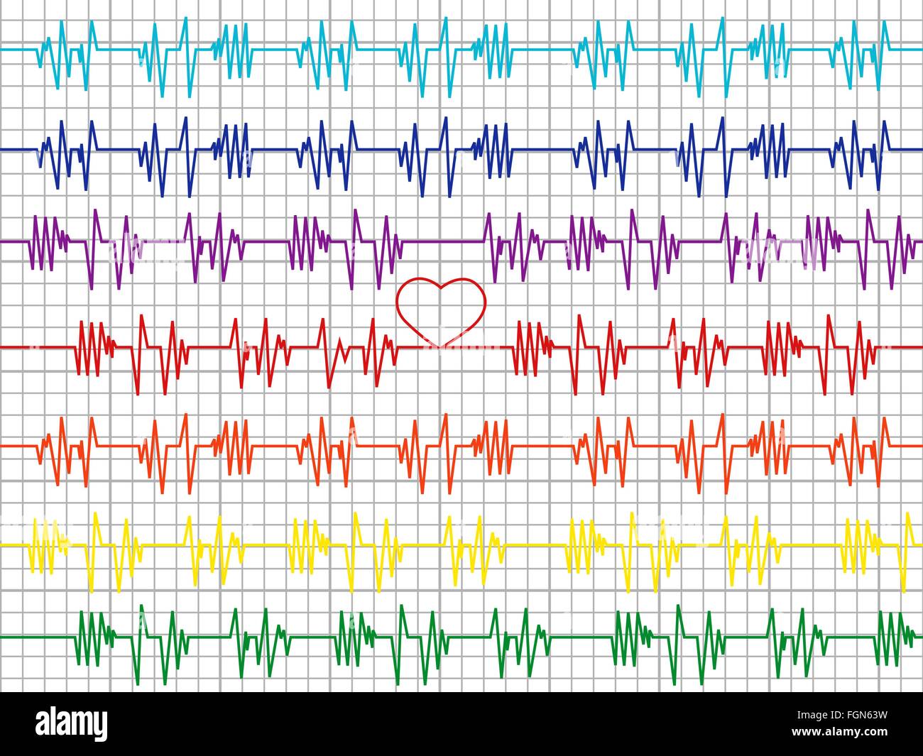 Heart failure electrocardiogram hi-res stock photography and images - Alamy