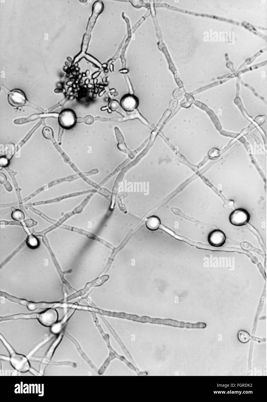 Trichophyton verrucosum hi-res stock photography and images - Alamy