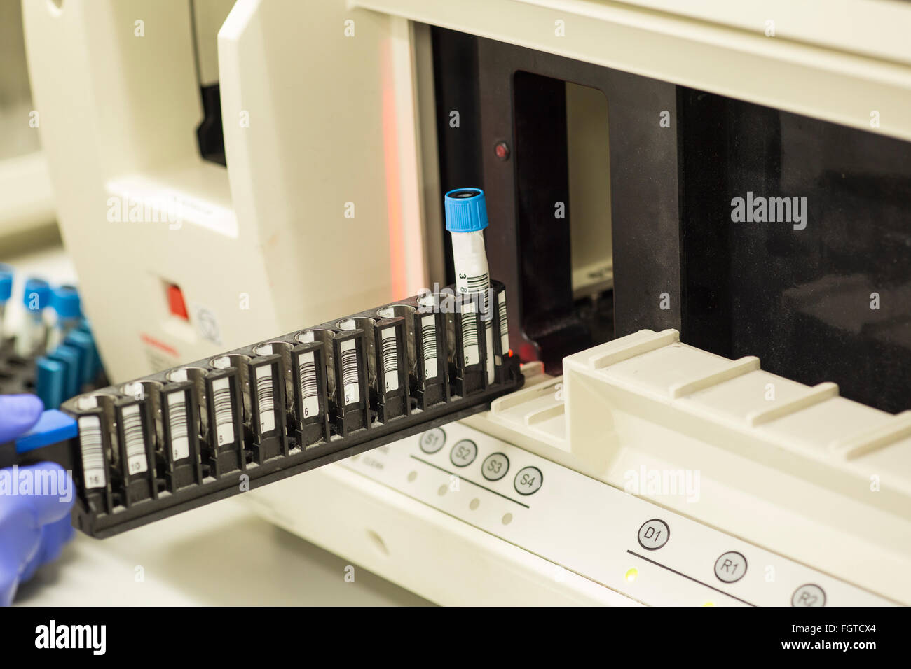 Coagulation hi-res stock photography and images - Alamy