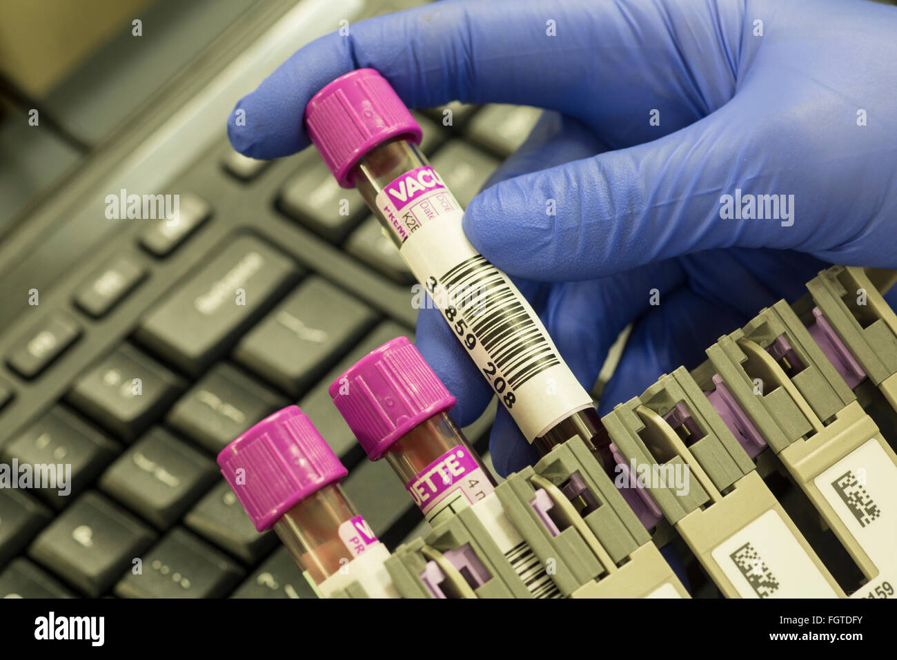 Blood analysis equipment in the pathology laboratory of a hospital ...