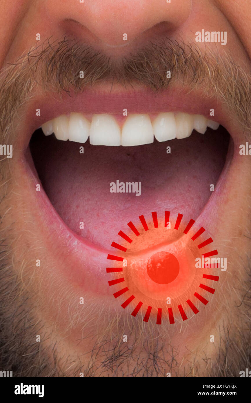 Close up teeth talking hi-res stock photography and images - Alamy