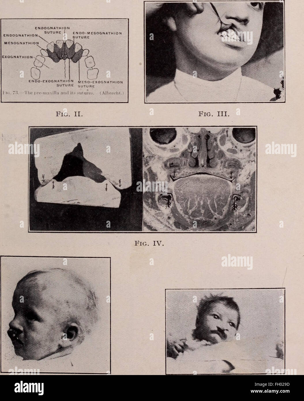 The 1909 edition of the Interstate Medical Journal covers a range of ...