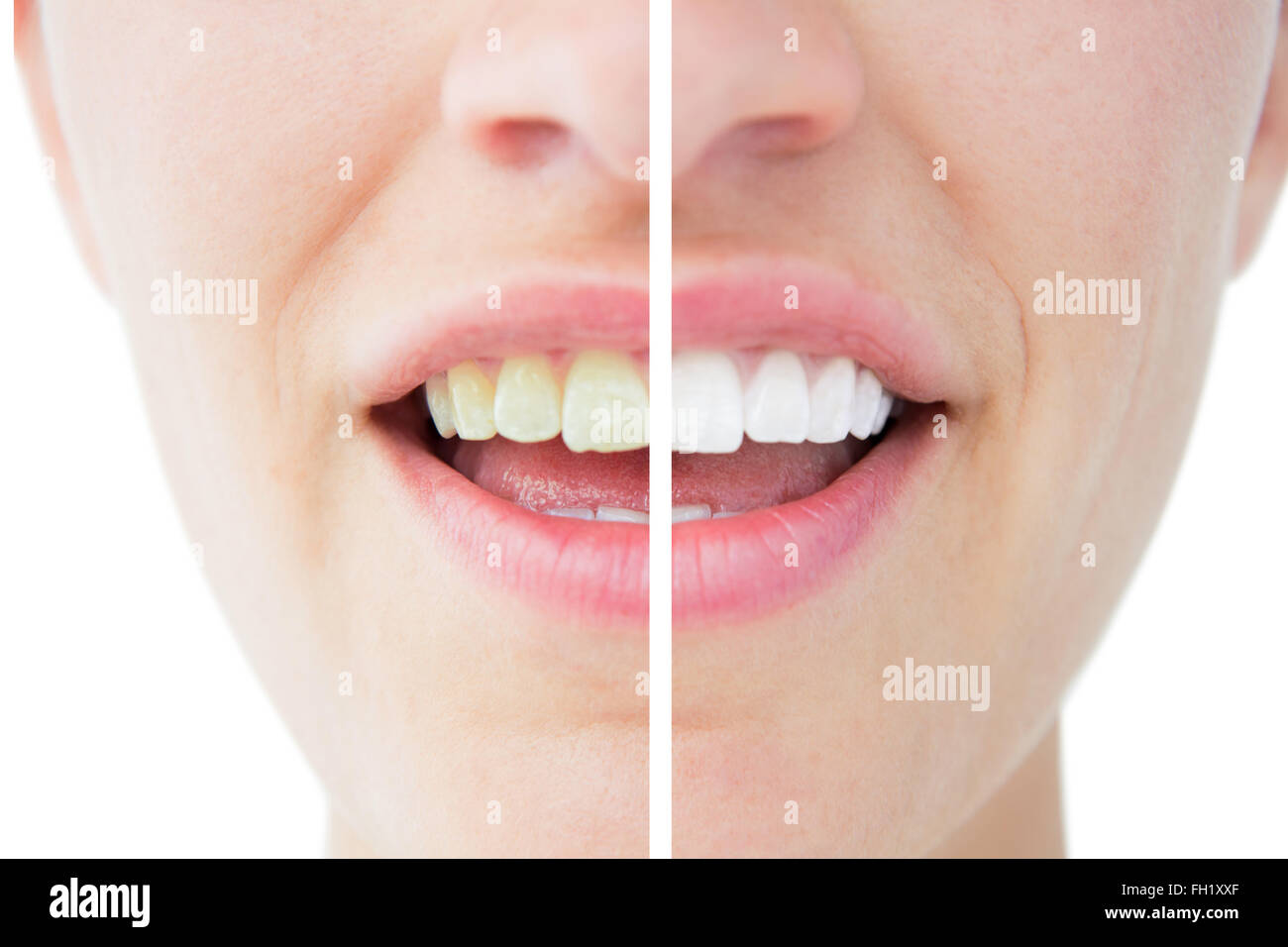 Pretty woman showing her teeth Stock Photo - Alamy