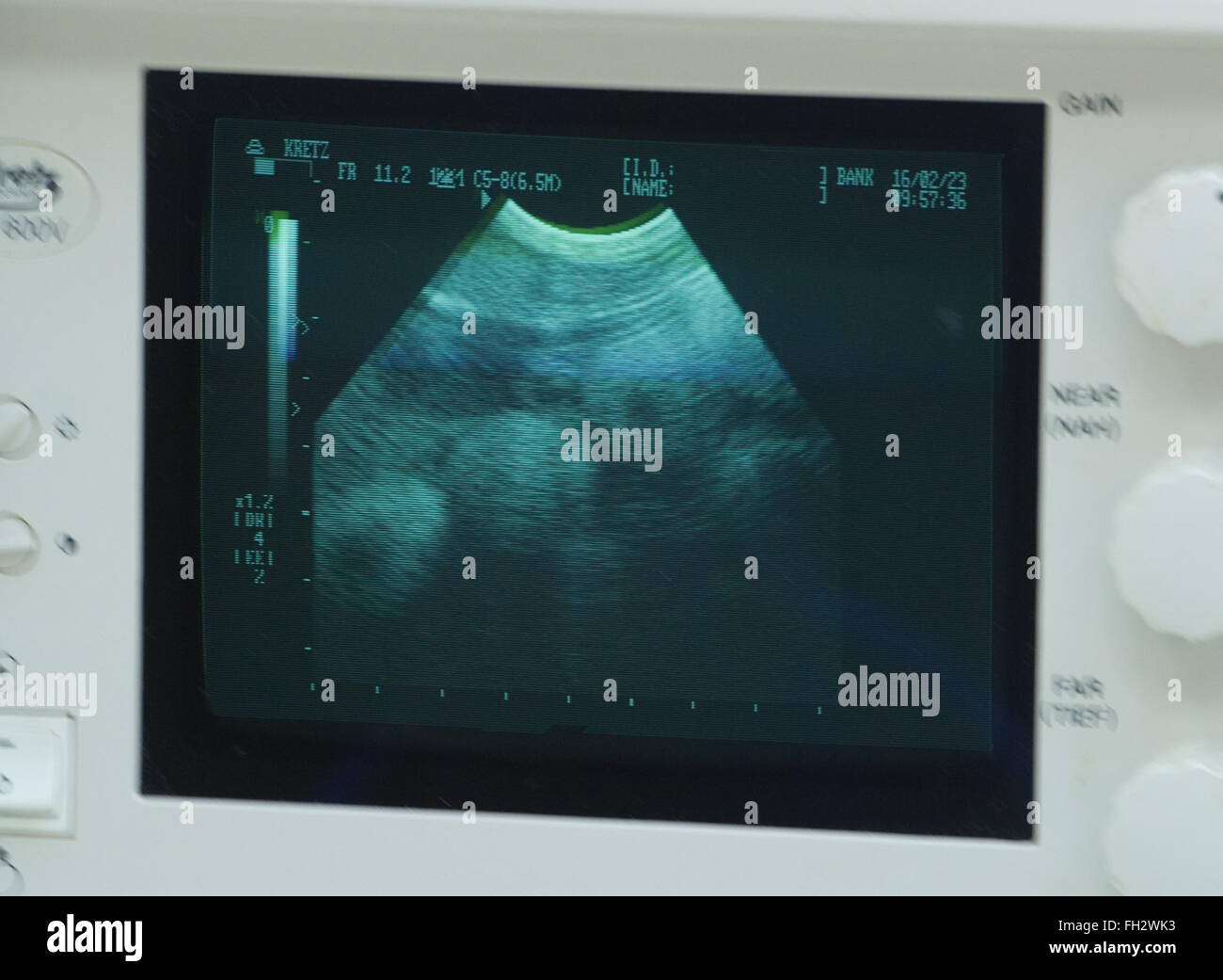 Stralsund, Germany. 23rd Feb, 2016. An ultrasound image shows the eggs ...