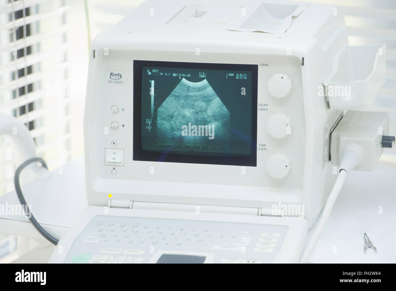 Stralsund, Germany. 23rd Feb, 2016. An ultrasound image shows the eggs ...